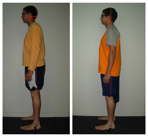 Lower Back Pain Success Stories | Back Pain Auckland